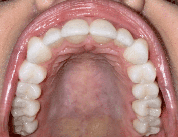 Teleorthodontics - Virtual Visit | Zeifman Orthodontics